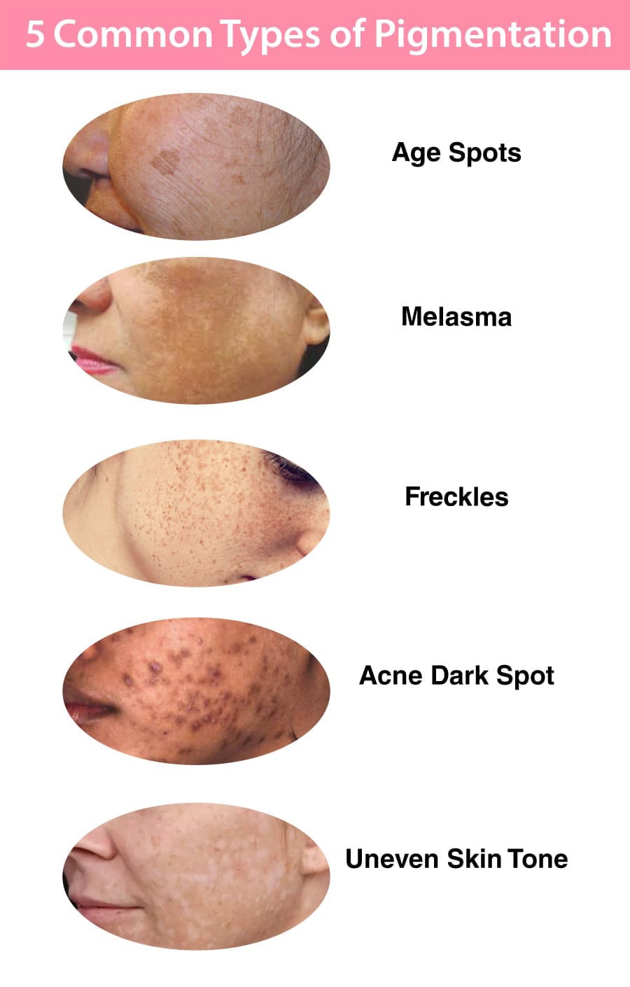 Free Treatment | Shakura Pigmentation Beauty